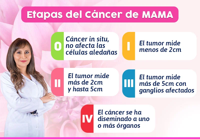 Etapas Del Cáncer De Mama SENOS LIBRES On X: "Cáncer De Mama